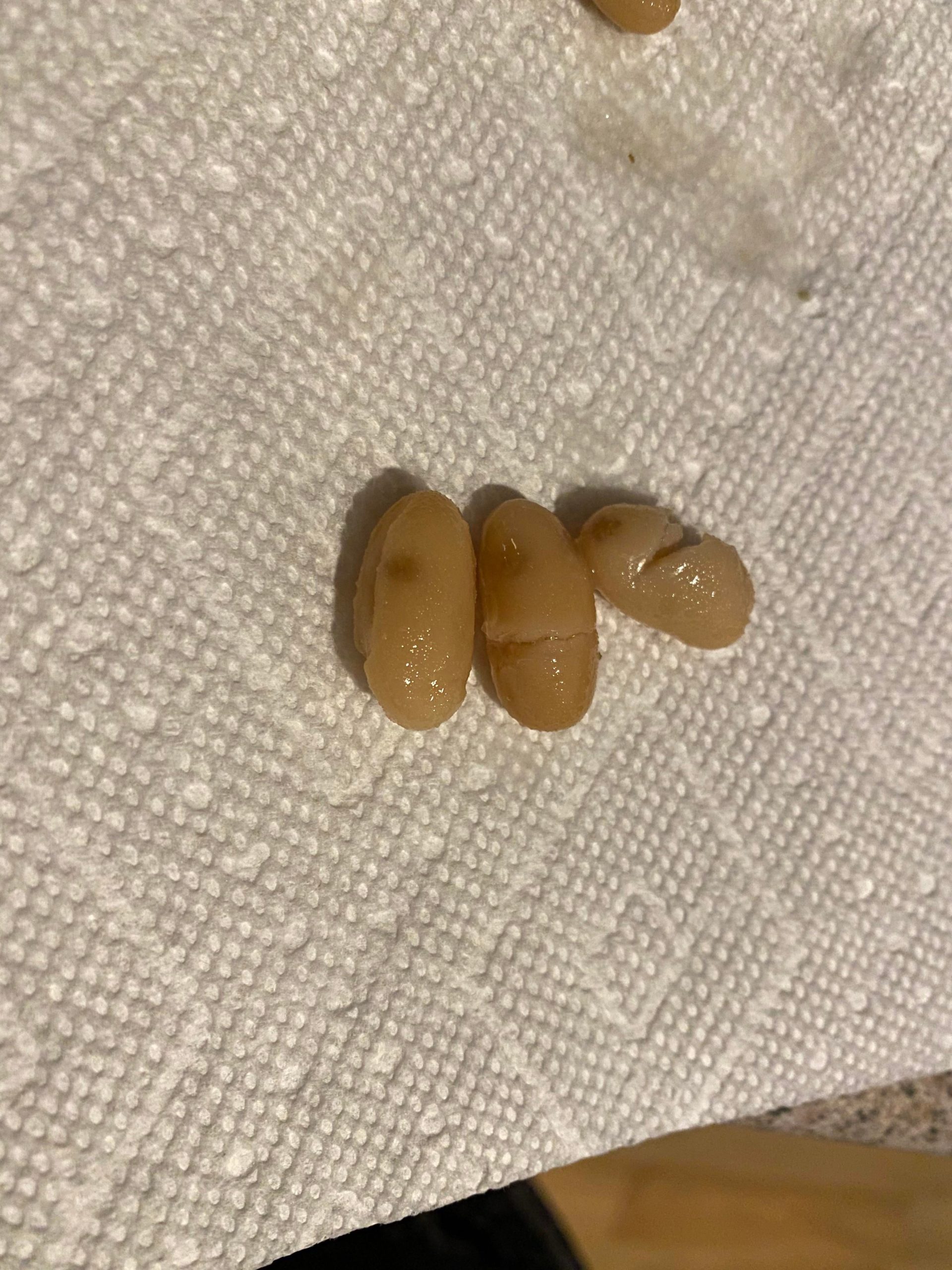 What Are These Brown Spots On My Cannellini Beans Eden Organic Found
