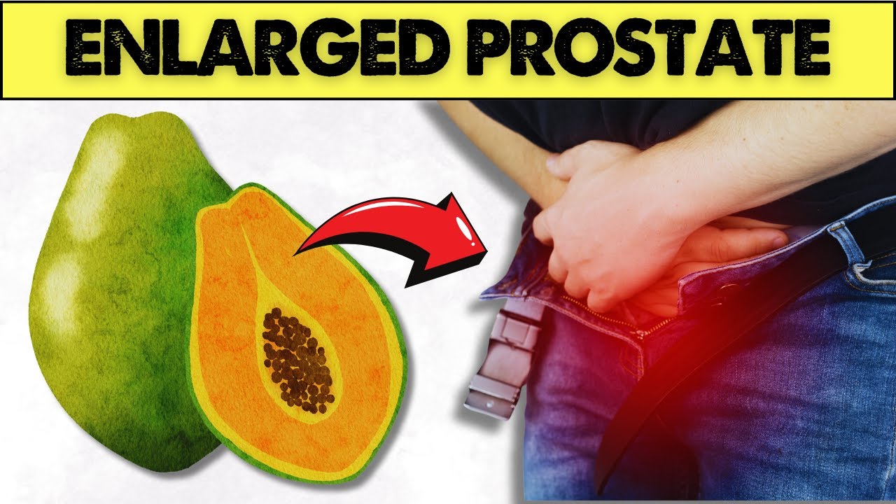 EAT NOW! 7 Simple And Effective Foods To Maintain Prostate Health ...